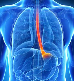 Specialists in Barretts Esophagus Disease | AZ Gastrointestinal Associates